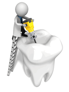 Dentist Chipping Away At Tooth | 3D Animated Clipart for PowerPoint ...